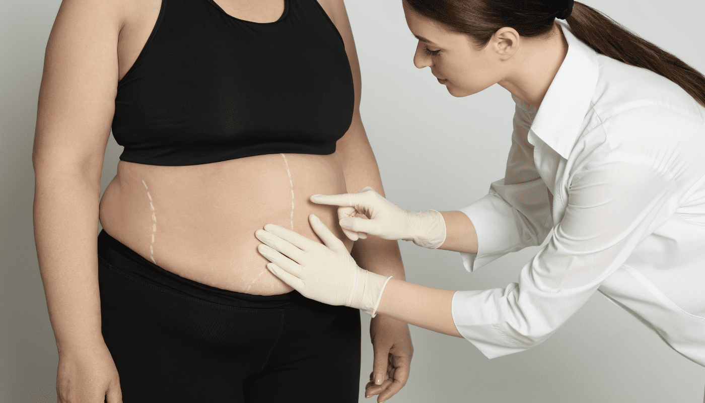 Which bariatric surgery is best for me?